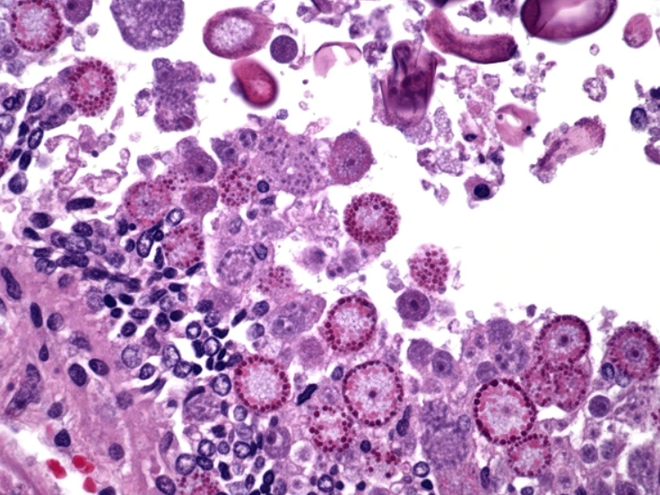 Coccidiosis Guide: Coccidiosis in Farm Animals and Humans — Roobeez